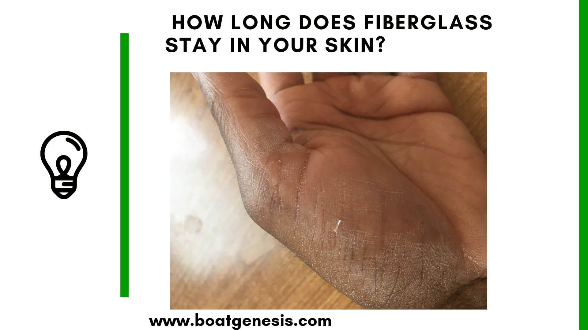 How Long Does Fiberglass Stay In Your Skin? | Boat Genesis